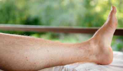 Was Übung mit einer Thrombose im Bein getan werden kann?